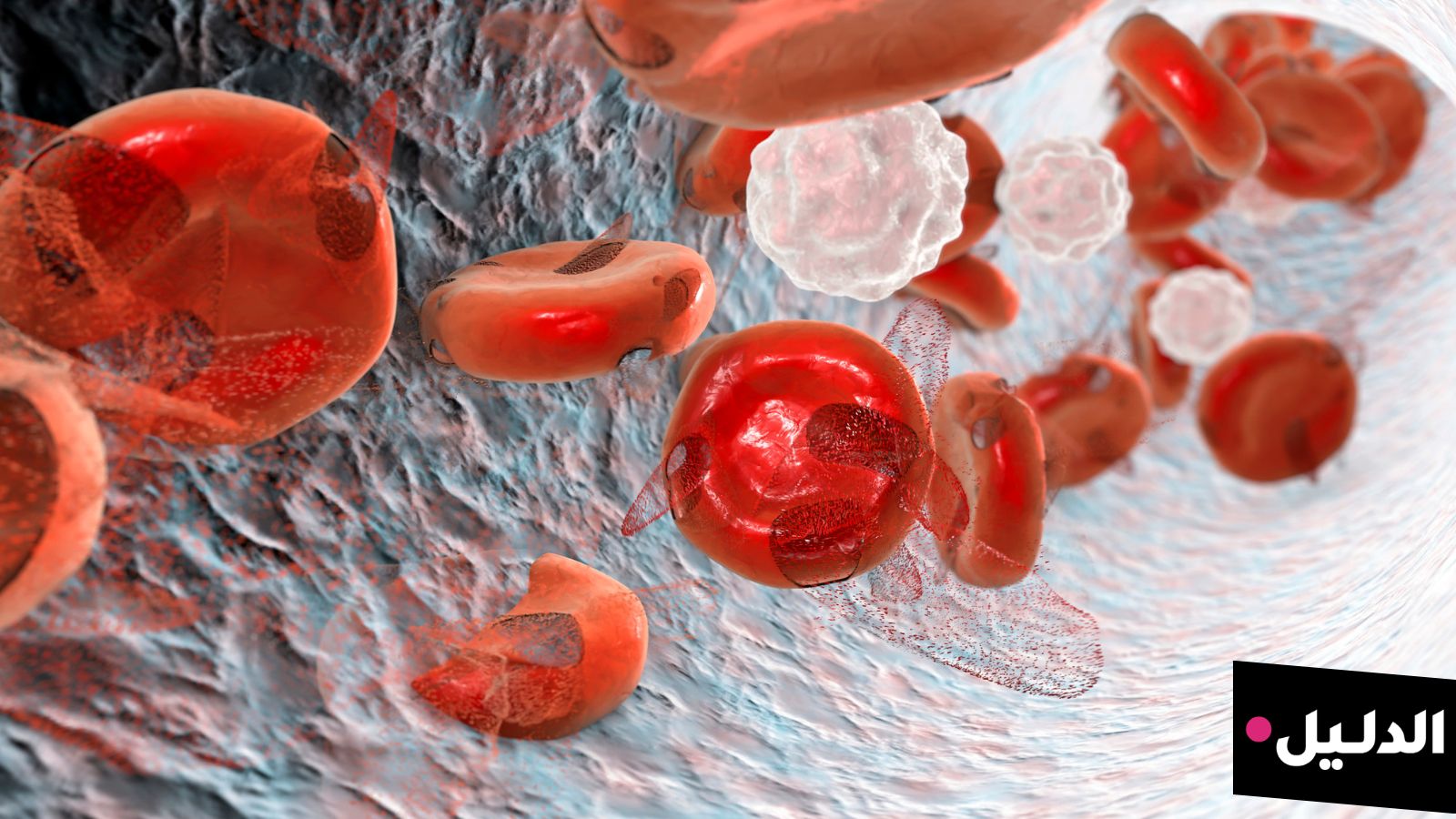فقر الدم الاسباب والوقاية والتعايش معه | الدليل